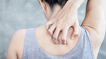 Say So Long to Psoriasis Itch | Kelsey-Seybold Clinic