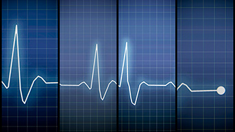 Why You Might Need a Stress Test - Kelsey-Seybold Clinic